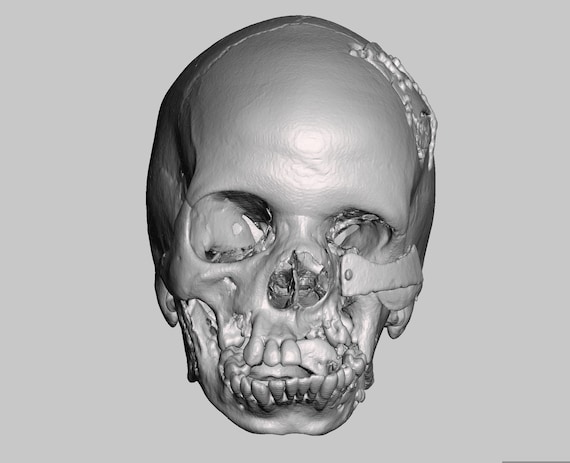 Real Human Skull Black And White
