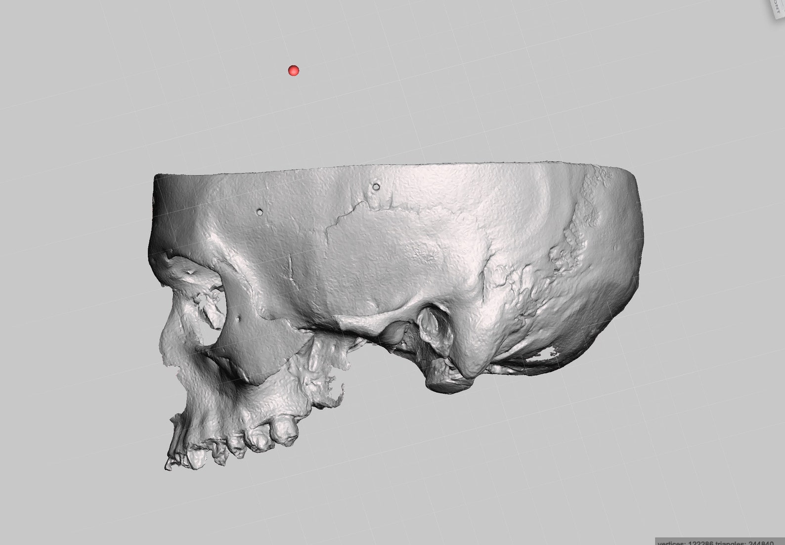 Human Skull STL, Cut in HALF. Teaching Tool Used in Forensic ...