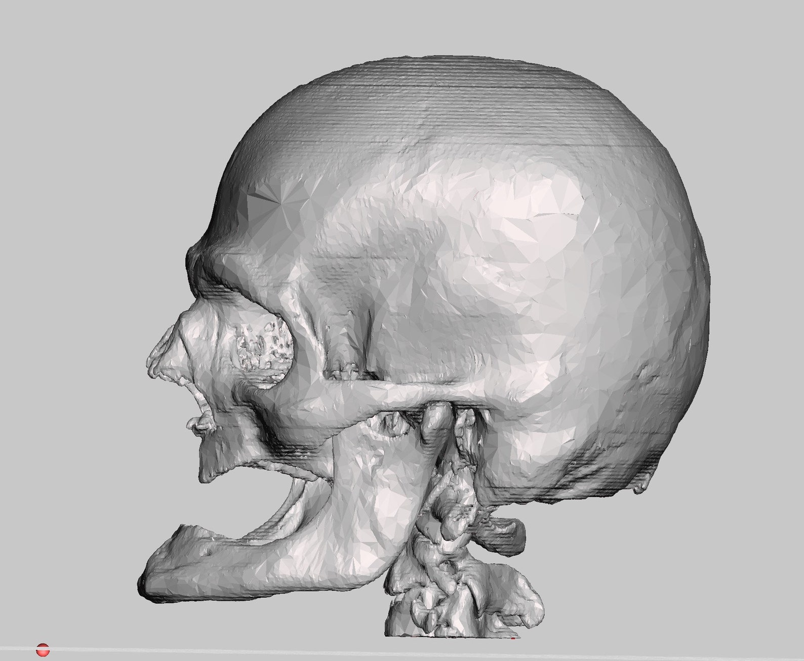 Unusual Male Skull, Edentulous (toothless), Quality High Resolution STL ...