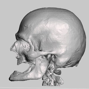 Unusual Male Skull, Edentulous (toothless), Quality High Resolution STL ...
