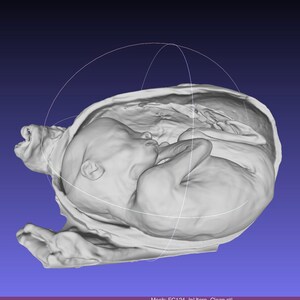 Cutaway View Human Fetus in Utero, 20 Week Old STL, Rare High ...