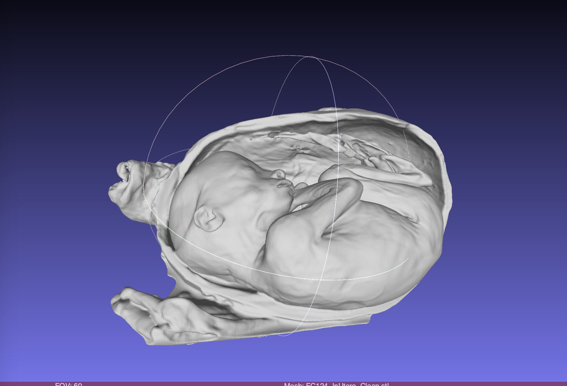 Cutaway View Human Fetus in Utero, 20 Week Old STL, Rare High ...