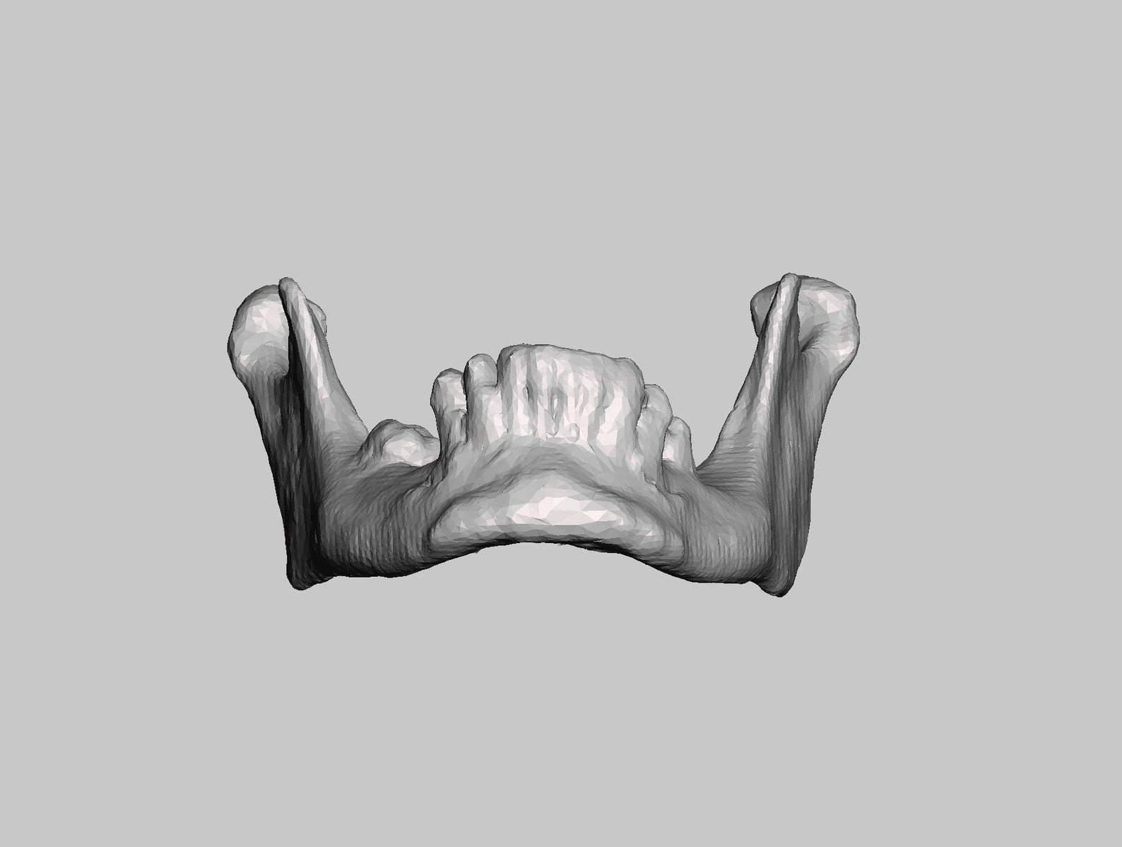 African American Male Skull and Jaw, LARGE Inion Hook (modern Human CT ...