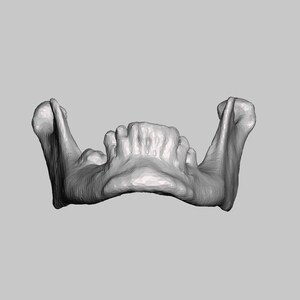 African American Male Skull and Jaw, LARGE Inion Hook (modern Human CT ...