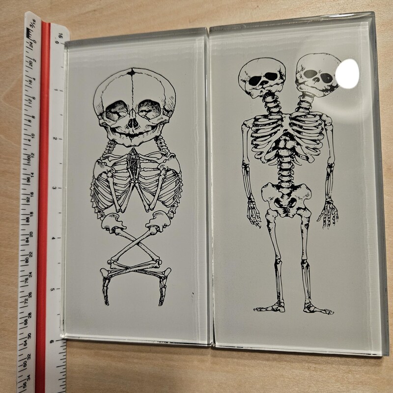 Conjoined Twin - Etsy