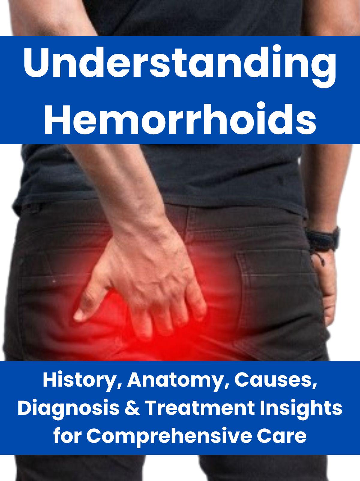 Understanding Hemorrhoids: History, Anatomy, Causes, Diagnosis ...