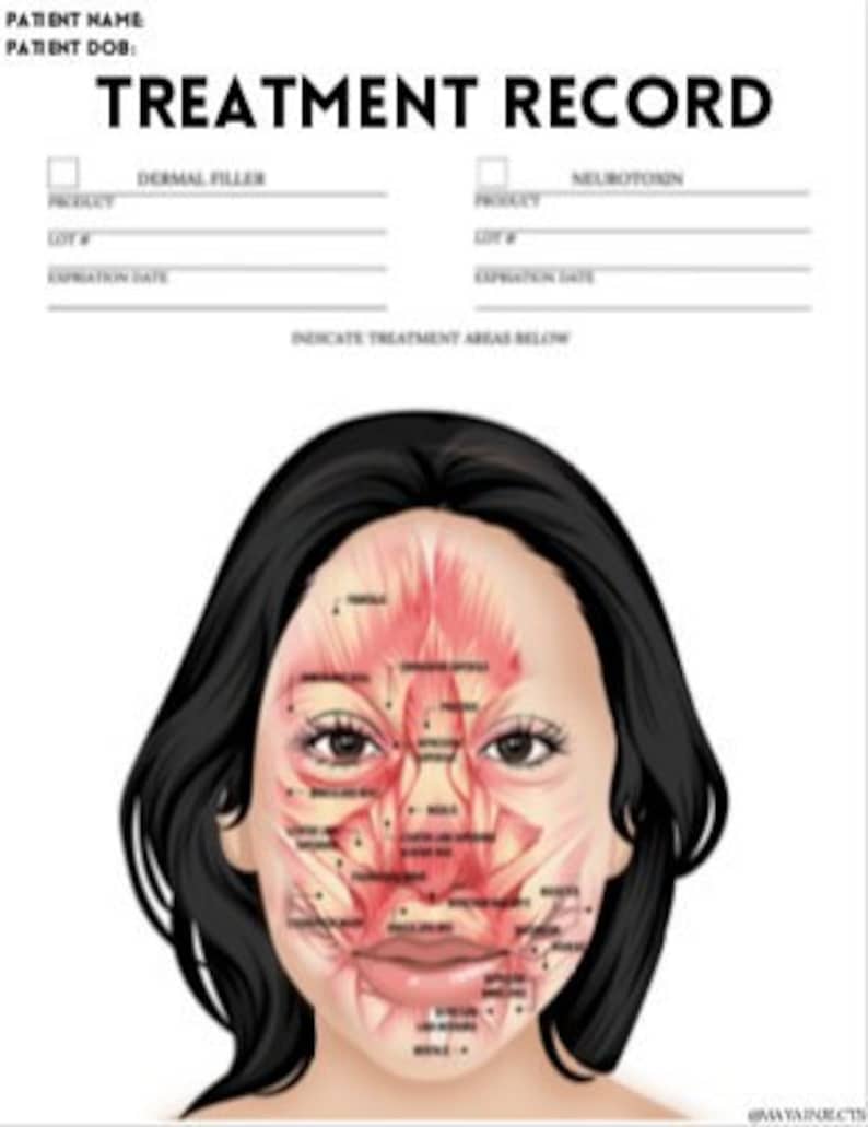 Botox & Filler Treatment Record and Anatomical Diagram Printable ...