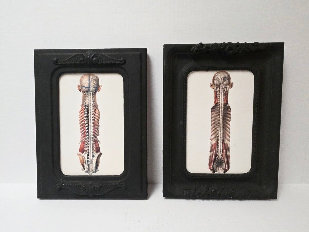 Vintage Framed Human Anatomy Brain, Spinal Chord, and Bones Print - Etsy