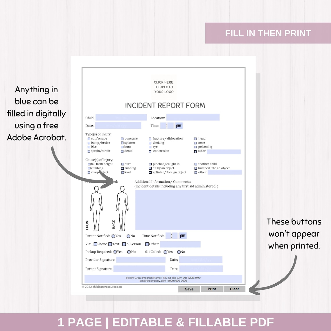 Daycare Incident Accident Report Form, Ouch Report, Family Home Daycare ...