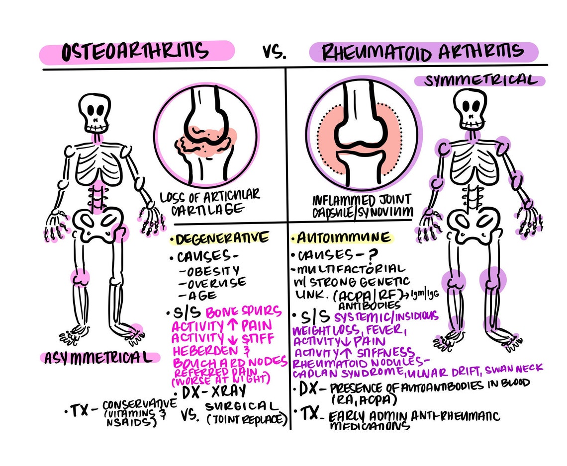 Musculoskeletal Alterations - Etsy