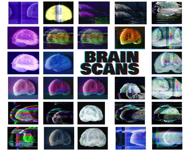 VHS Textures Background Pack - Brain Scans - Etsy