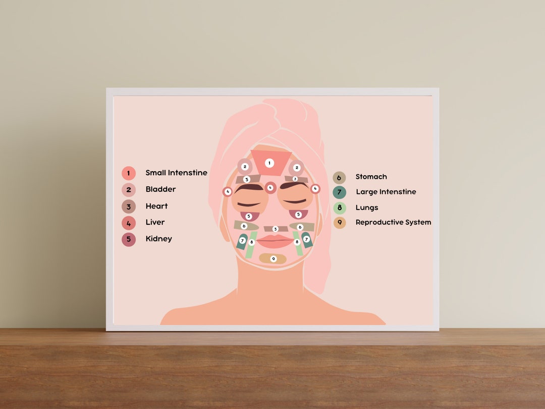 Acne Face Map Downloadable Poster Print - Etsy