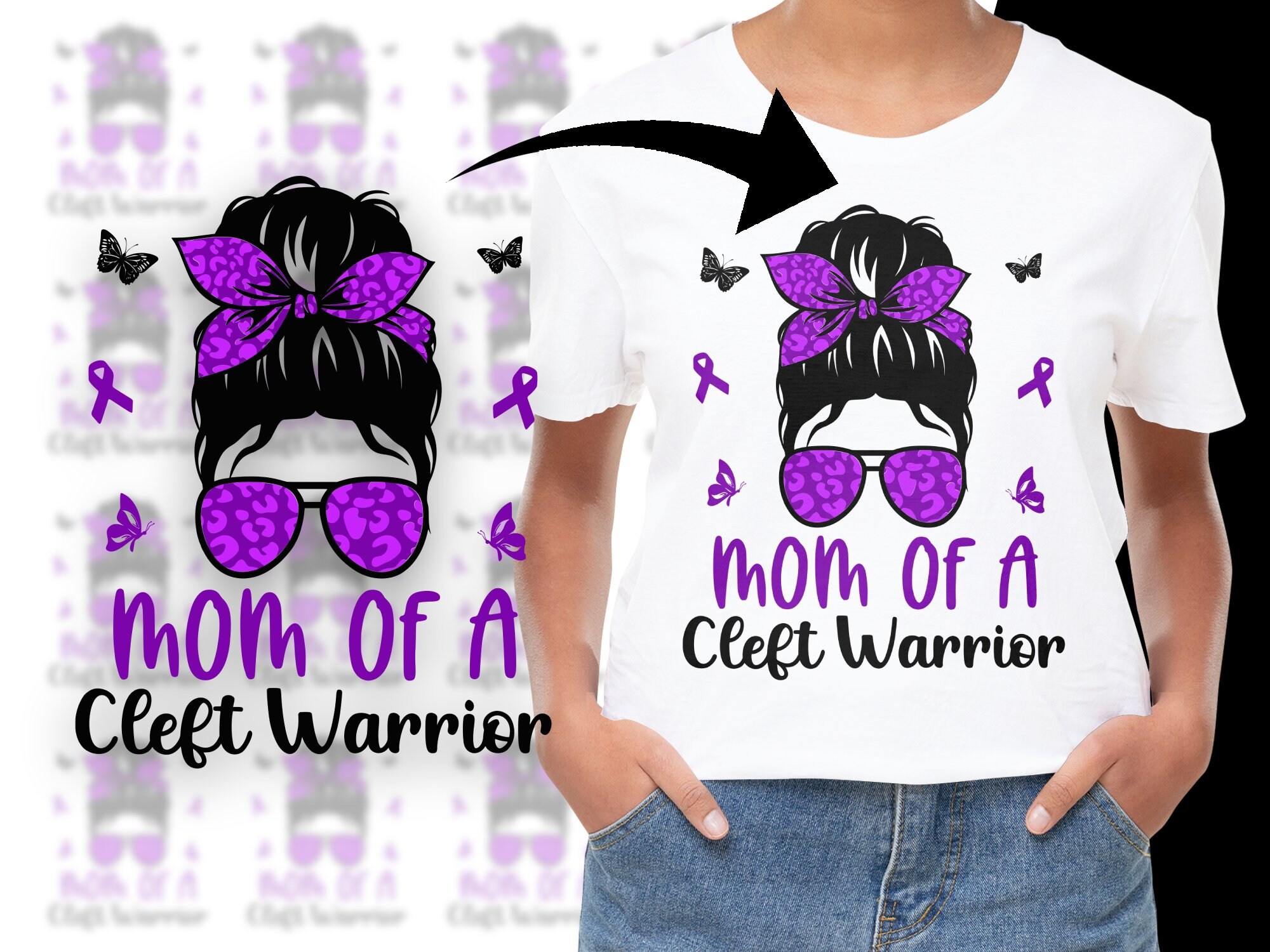 Cleft Craniofacial Awareness Svg Png Mom of a Cleft Warrior - Etsy