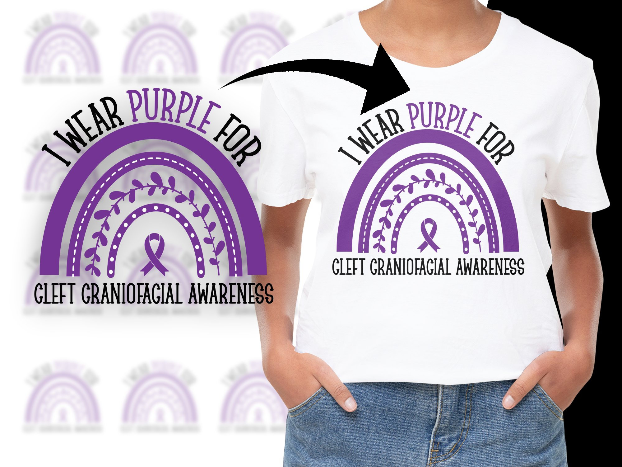Cleft Craniofacial Awareness Svg Png, I Wear Purple for Svg, Purple ...
