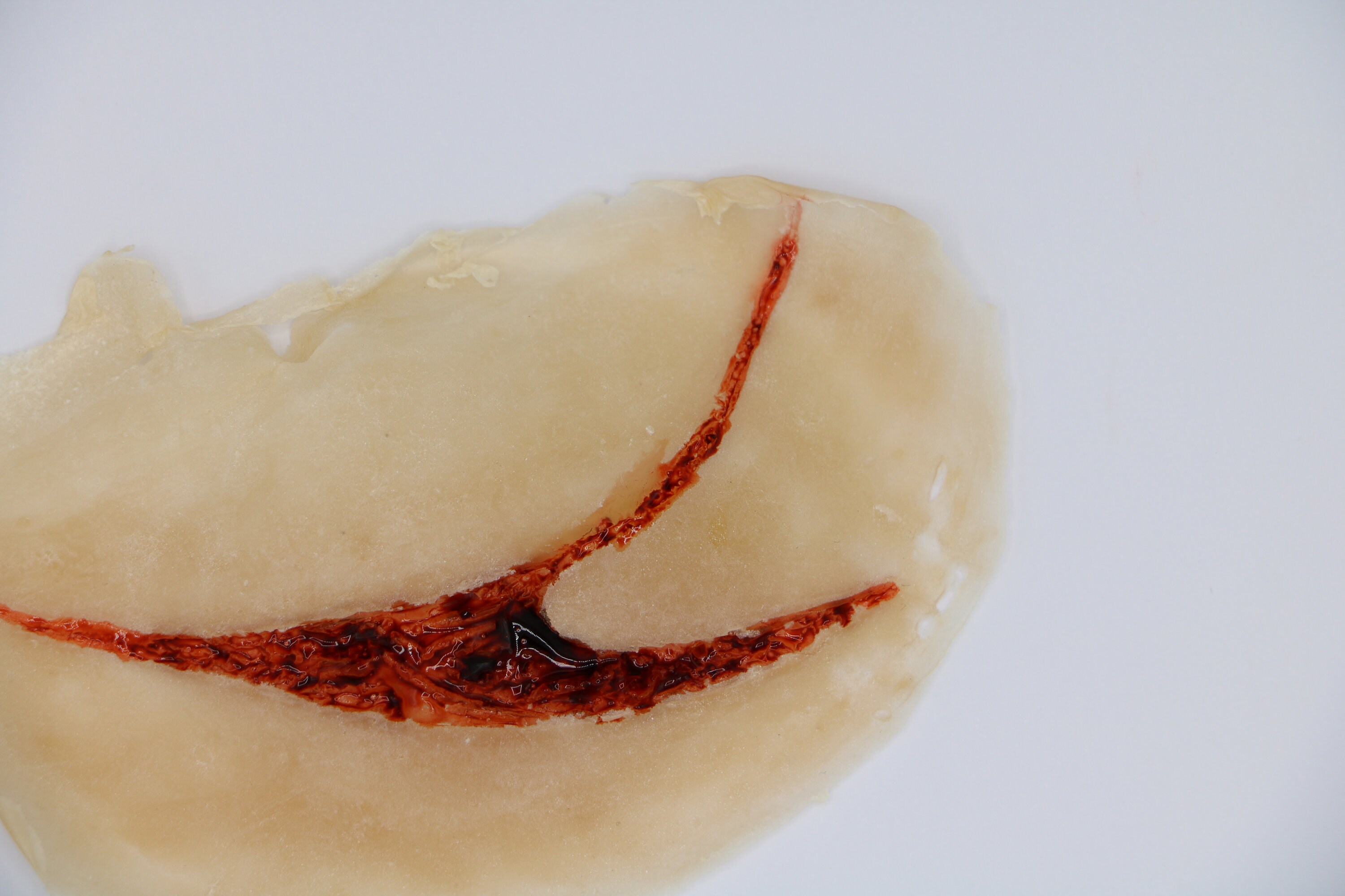 Latex Skin Flap Wound. Prosthetic Appliance. Skin Flap. Halloween. Film ...