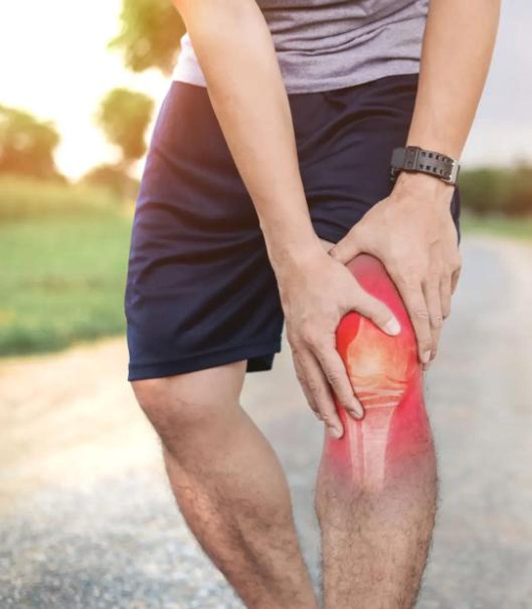 Printable ACL Rehab Tracker – Knee Injury Recovery Log, Physiotherapy ...