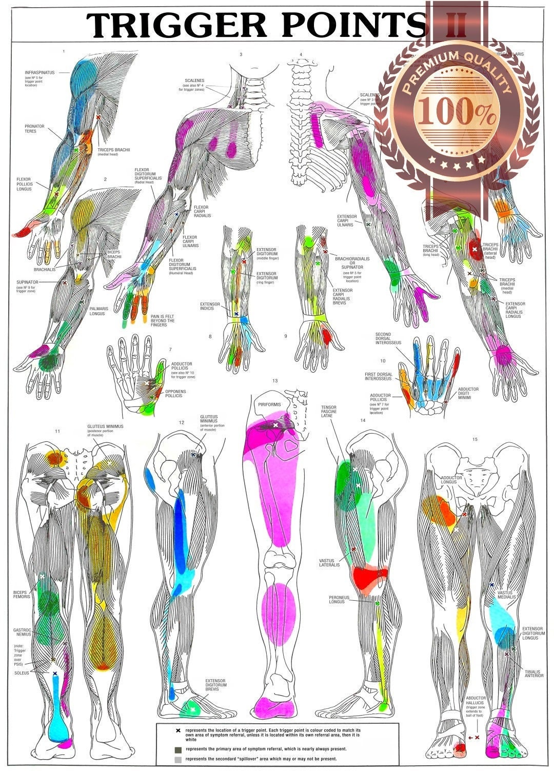 Trigger Points Part 2 Single Premium Waterproof Tear Proof Poster ...