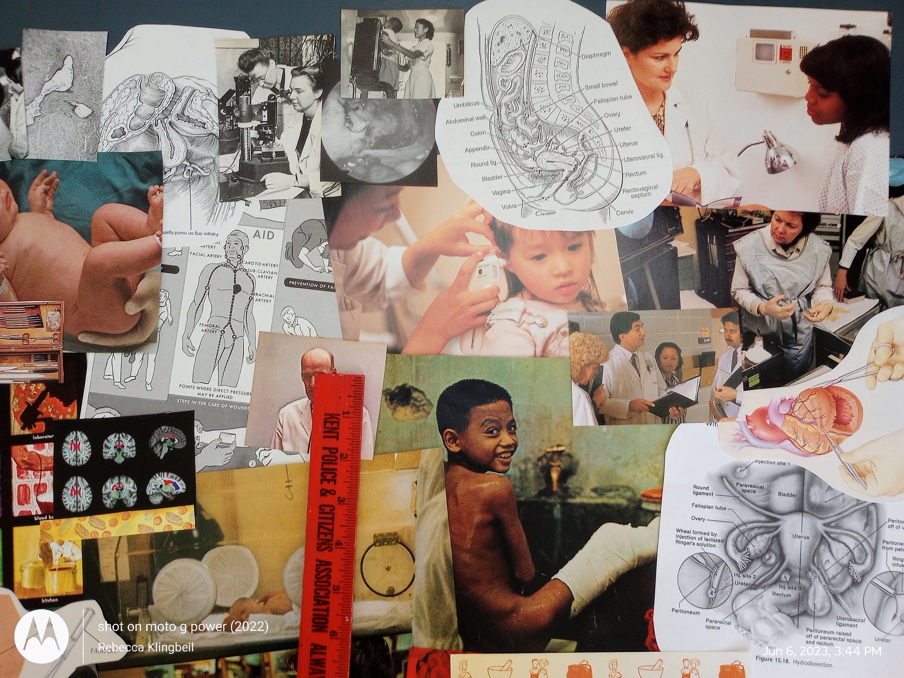 MEDICAL / HEALTH #1 Collage Cutout Bundle Pack: 50+ MEDICAL Cutout ...