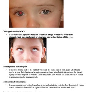 UWORLD- NCLEX REVIEW- Ophthalmology - Etsy
