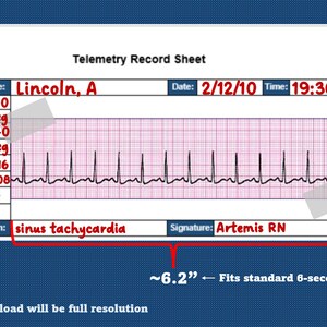 Telemetry/ekg Nurse Report Sheet - Etsy