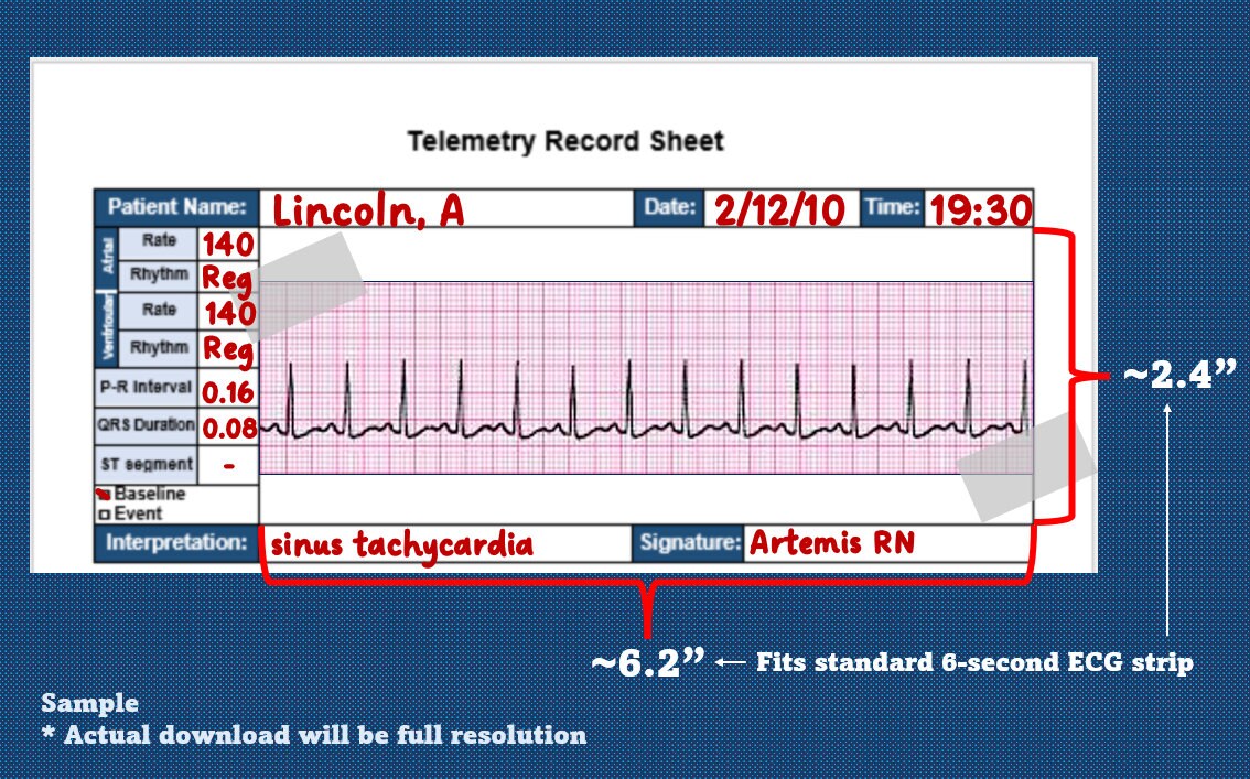 Telemetry/ekg Nurse Report Sheet - Etsy