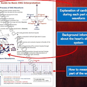 EKG Interpretation Guide - Etsy