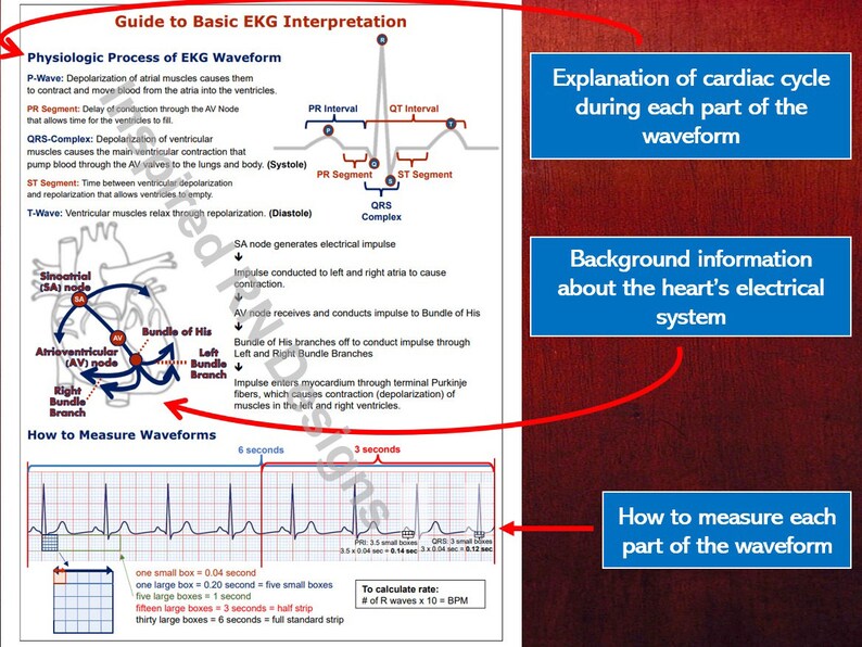 EKG Interpretation Guide - Etsy