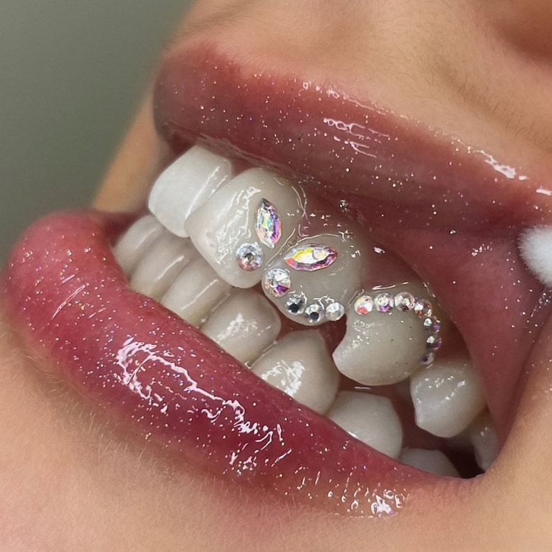 DIY Tooth Gem Kit | Fly W Me Tooth Gem Kit - Etsy
