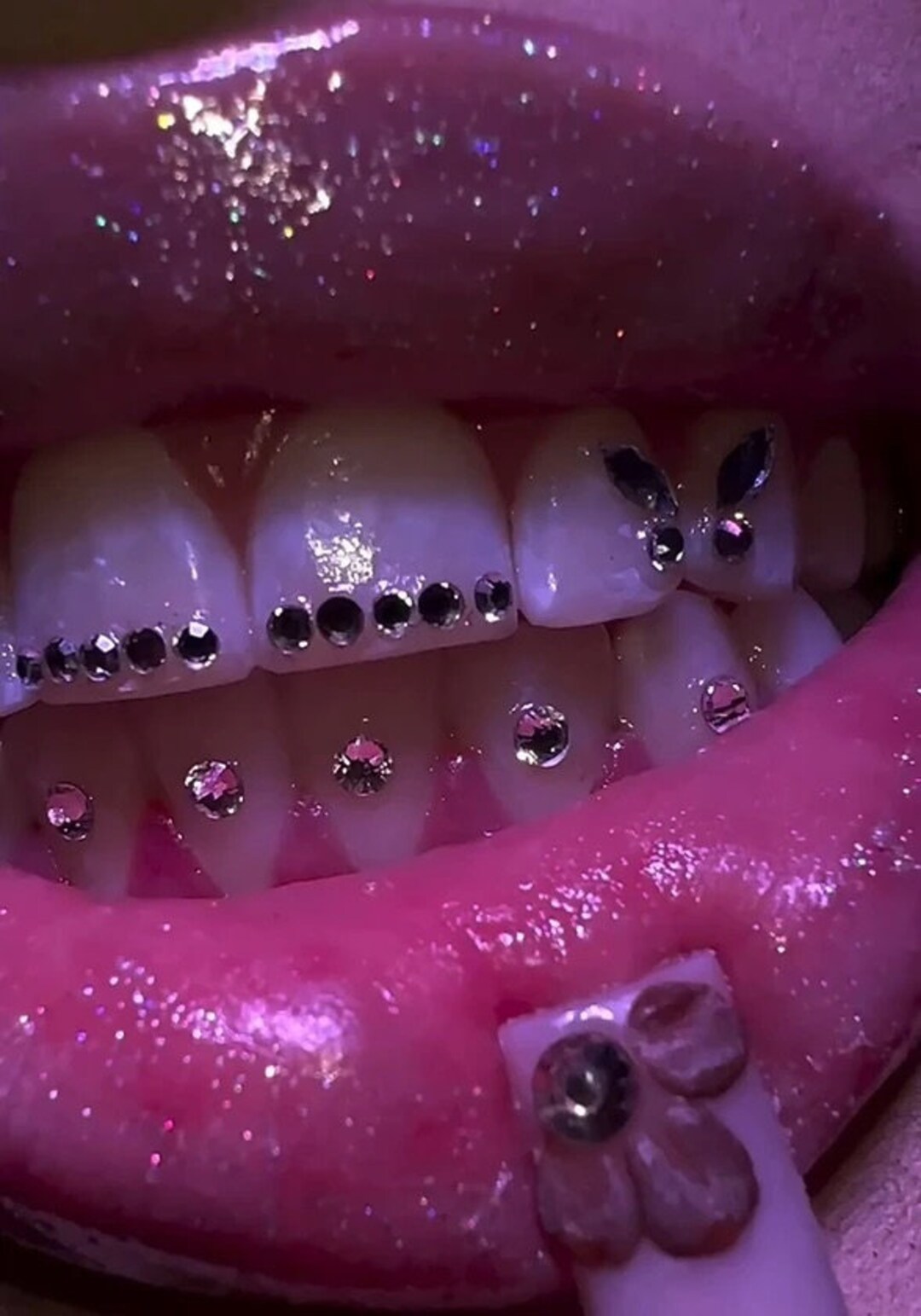 Icy Girl 2.0 Tooth Gem Set DIY Tooth Gem Kit - Etsy