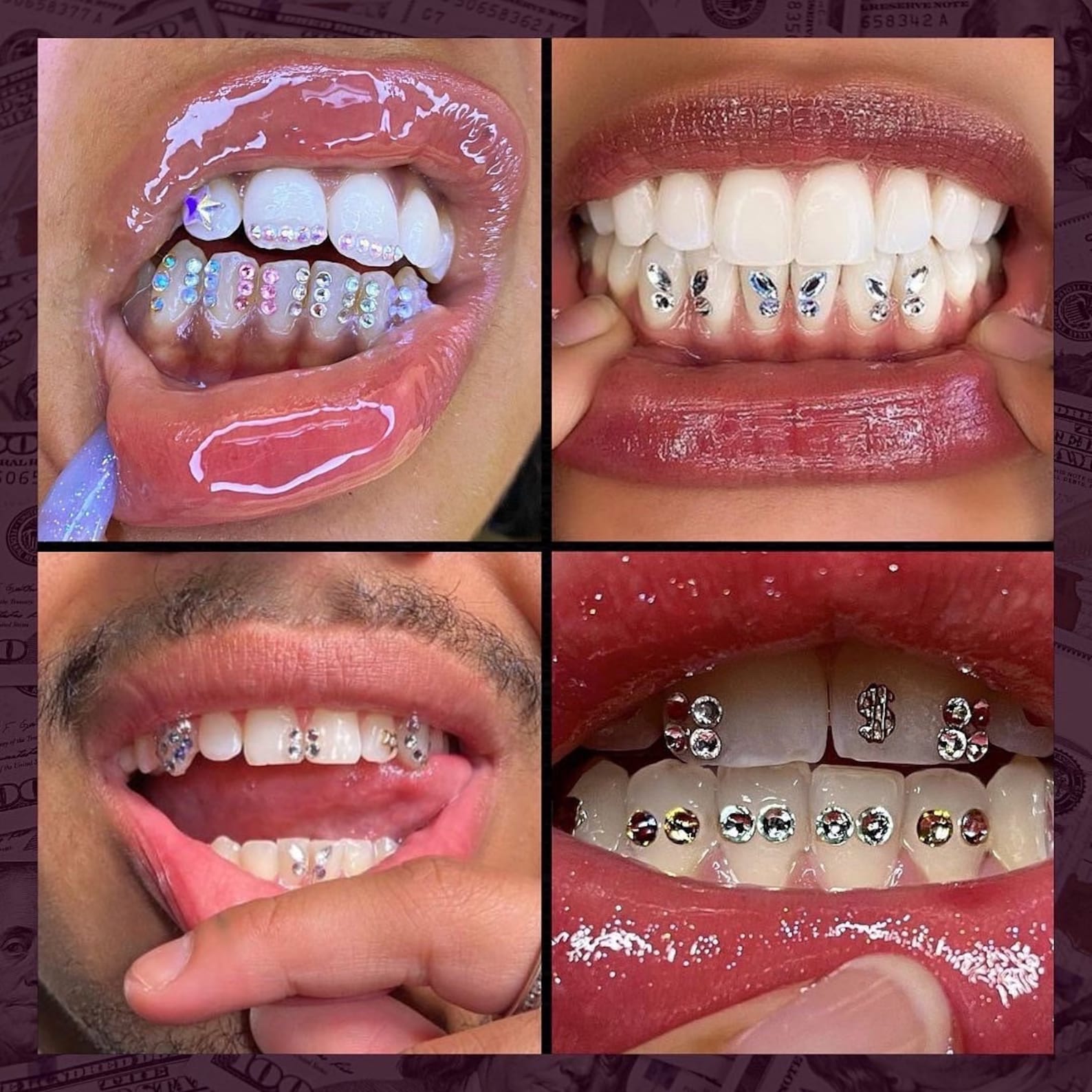 Butterfly Bloom DIY Tooth Gem Kit - Etsy