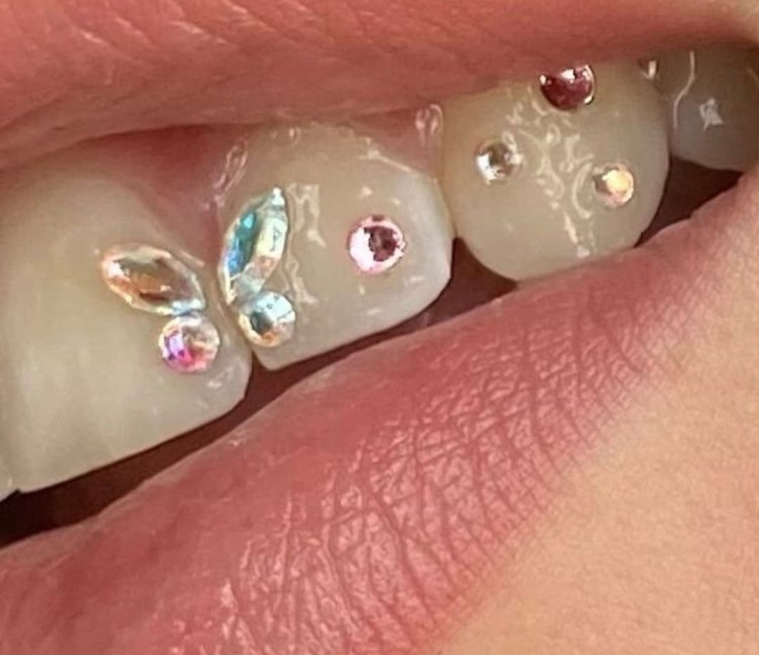 Butterfly AB Set | DIY Tooth Gem Kit - Etsy