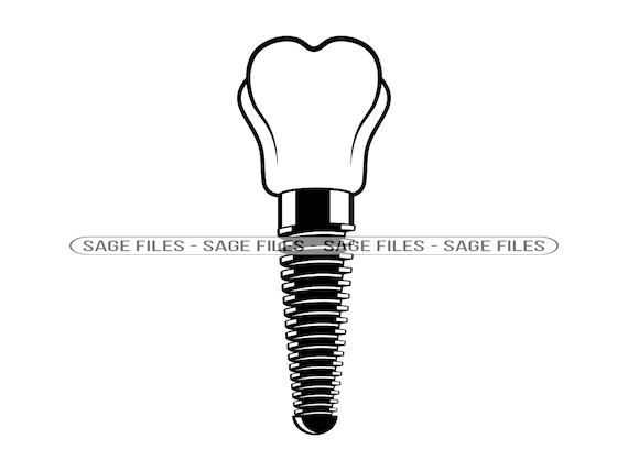 Dental Implant SVG Dentist Svg Tooth Svg Dental Implant - Etsy