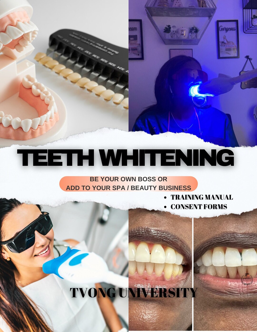 Teeth Whitening Training-spa Course- Training Manual- Whiter Teeth ...