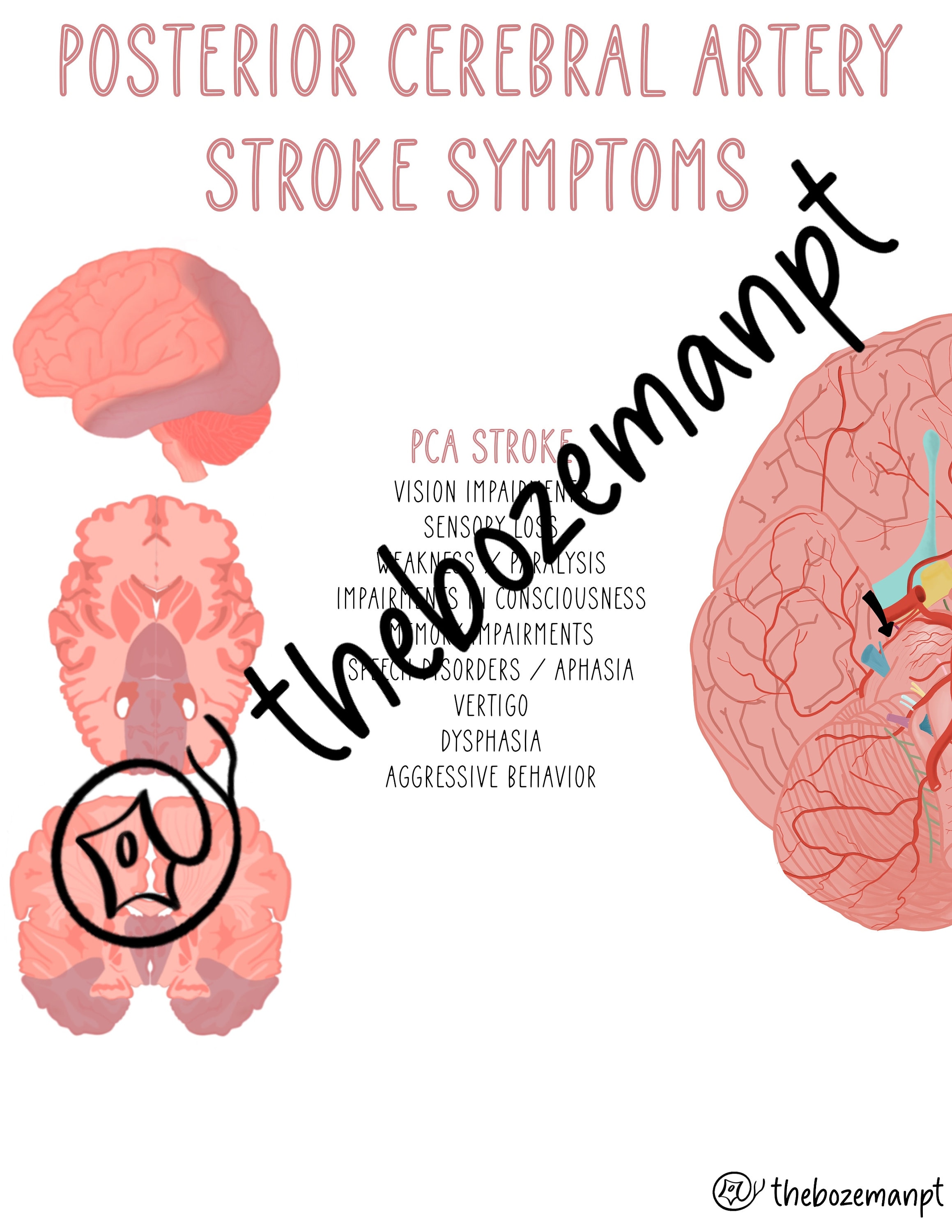 Stroke Symptom and Anatomy Educational Handout - Etsy
