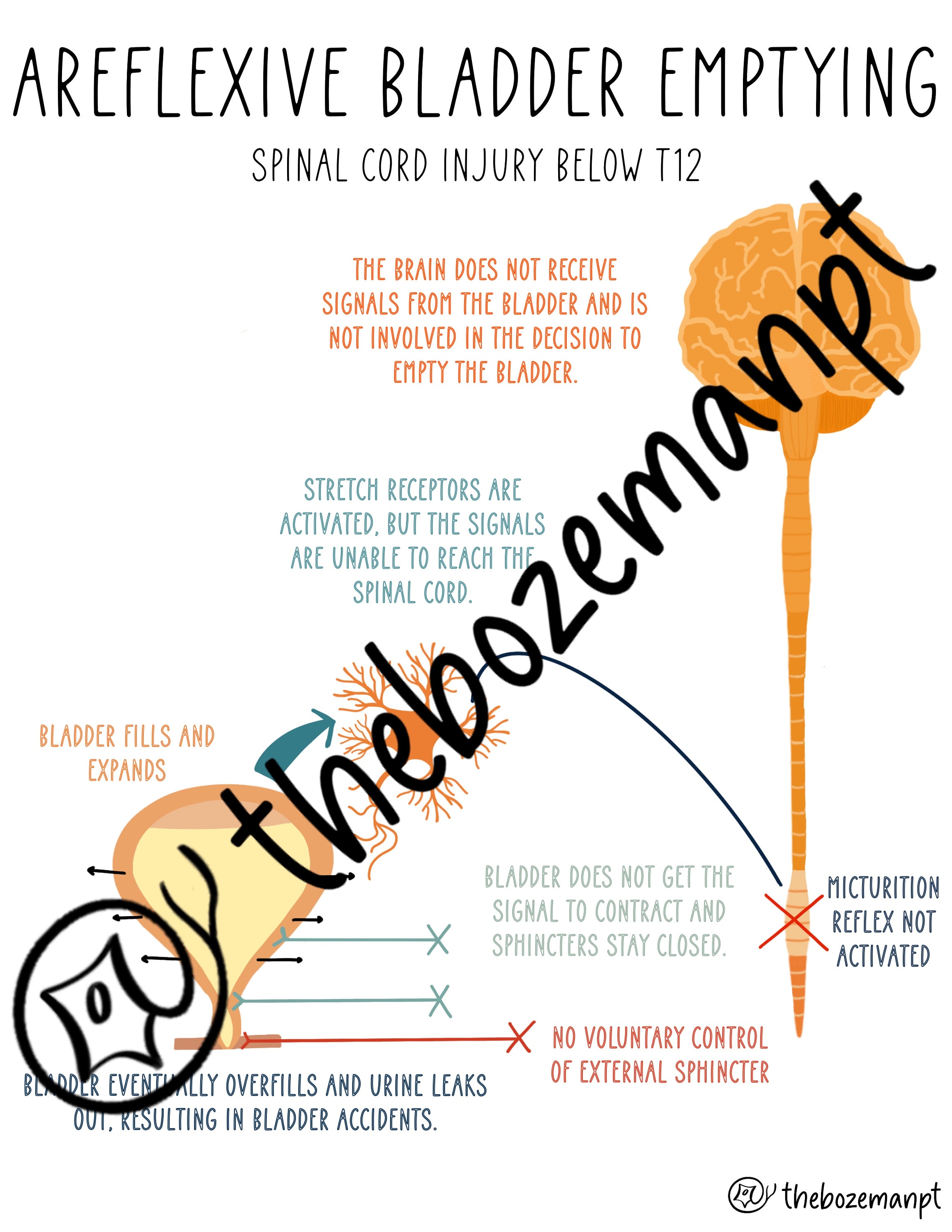 Bowel and Bladder Emptying - Spinal Cord Injury - Neurological Injury ...