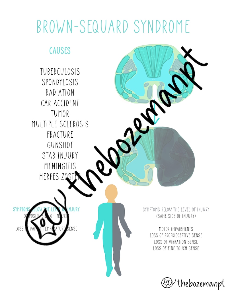 Common Spinal Cord Injuries Handout and Study Guide - Etsy