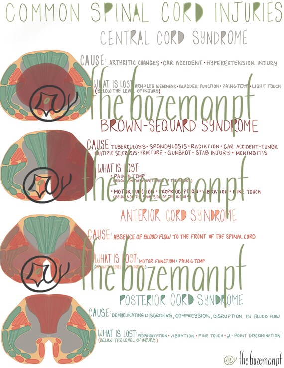 Common Spinal Cord Injuries Symptoms - Etsy