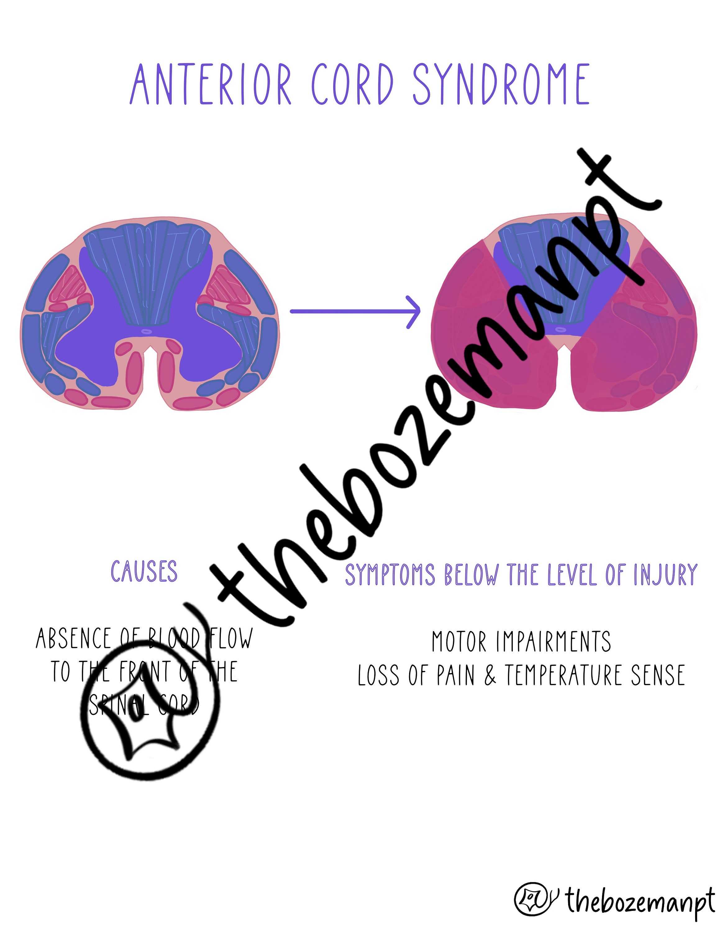 Common Spinal Cord Injuries Handout and Study Guide - Etsy
