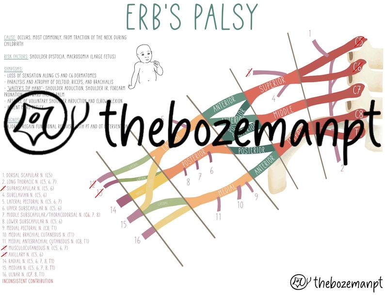 Brachial Plexus Diagram, Erb's Palsy, Klumpke's Palsy, Study Guide - PT ...