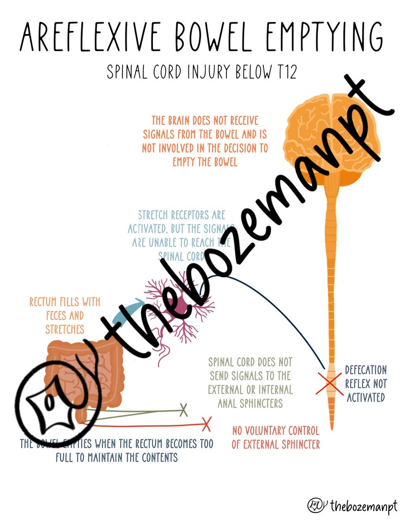 Bowel and Bladder Emptying - Spinal Cord Injury - Neurological Injury ...