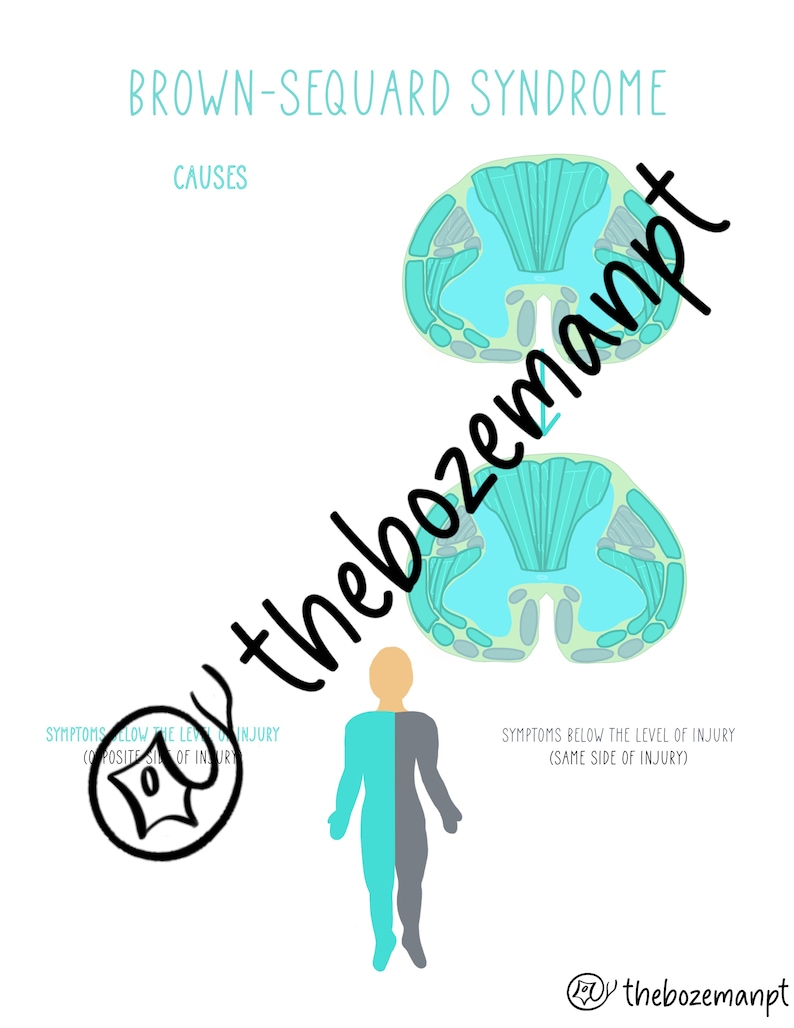 Common Spinal Cord Injuries Handout and Study Guide - Etsy