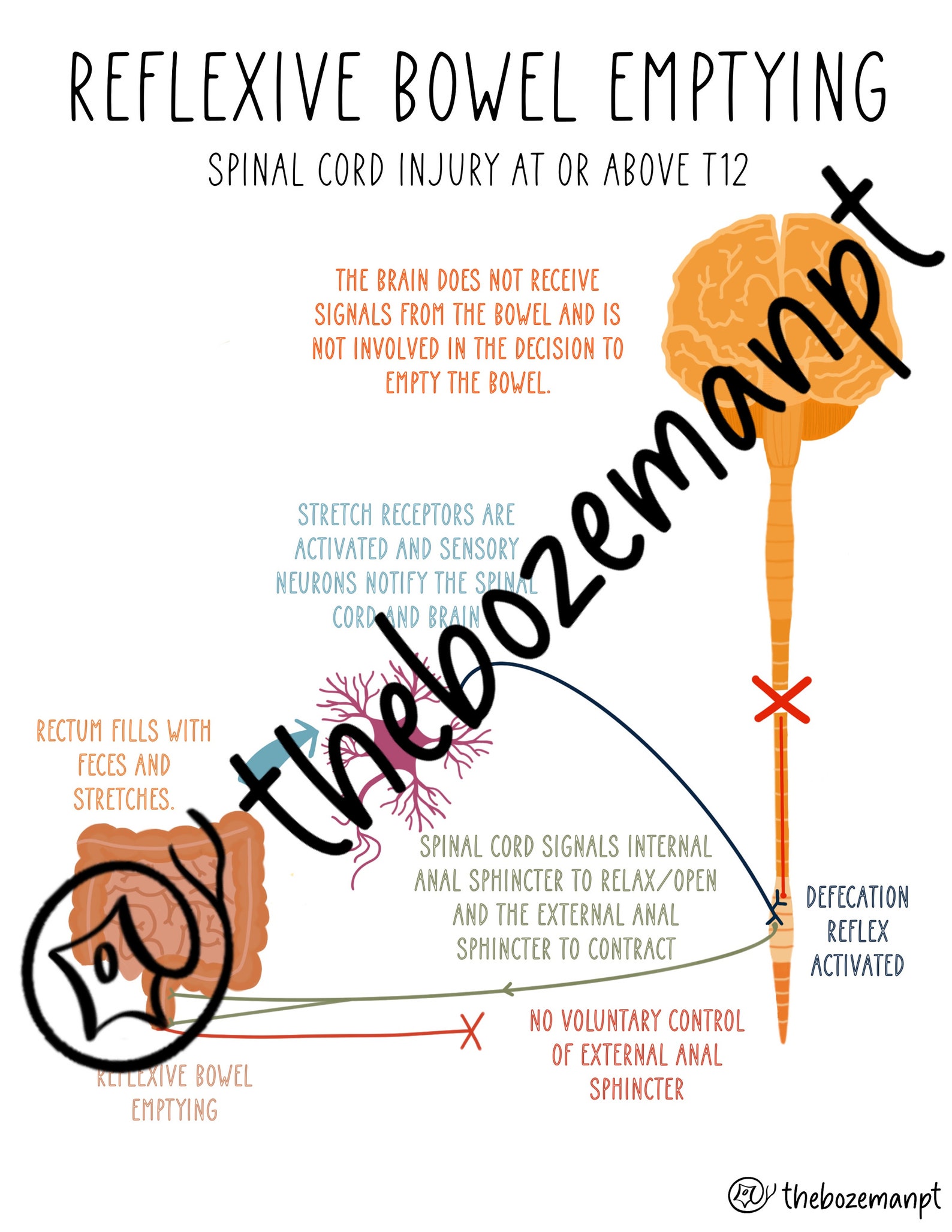 Bowel and Bladder Emptying - Spinal Cord Injury - Neurological Injury ...