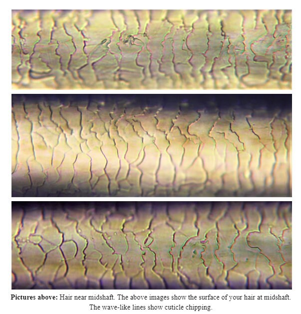 Microscopic Hair Analysis - Etsy