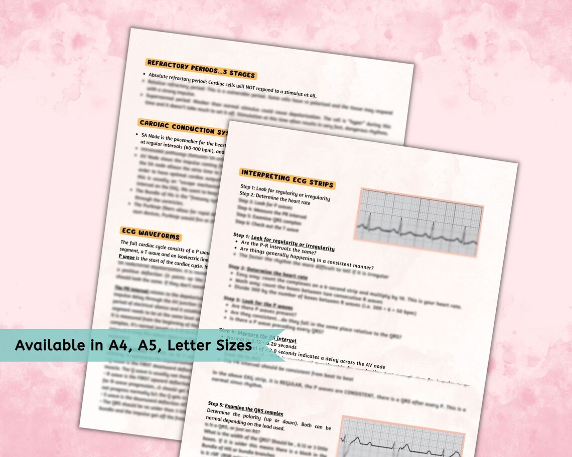 Ekg Study Guide, Ekg Interpretation, Ekg Rhythm, Ekg Cheat Sheet ...