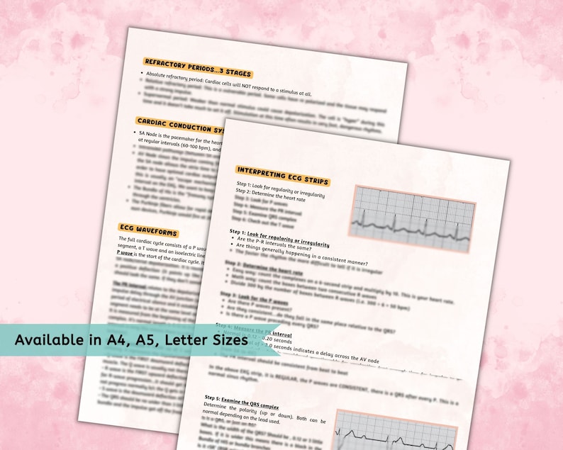 Ekg Study Guide, Ekg Interpretation, Ekg Rhythm, Ekg Cheat Sheet ...
