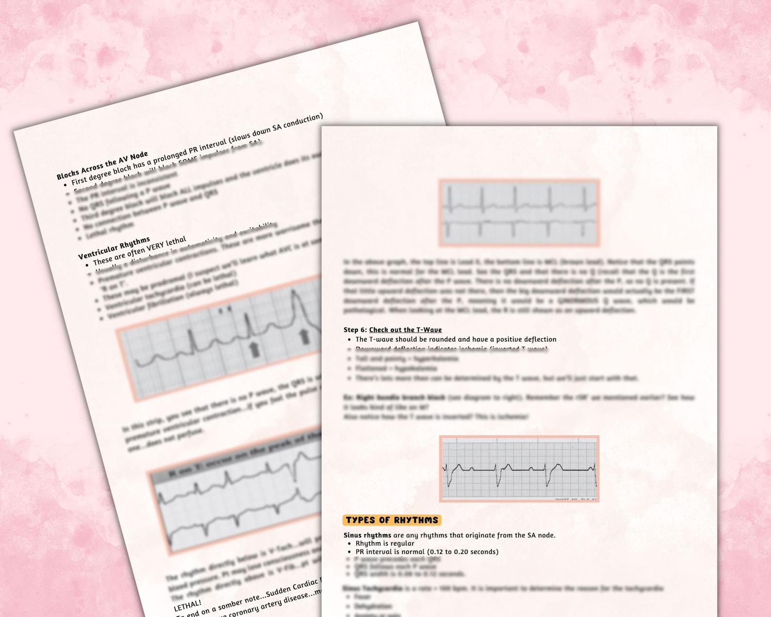 Ekg Study Guide, Ekg Interpretation, Ekg Rhythm, Ekg Cheat Sheet ...