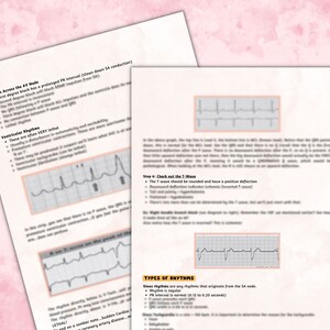 Ekg Study Guide, Ekg Interpretation, Ekg Rhythm, Ekg Cheat Sheet ...
