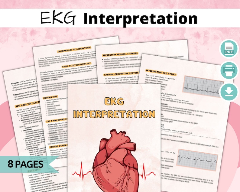 Ekg Study Guide, Ekg Interpretation, Ekg Rhythm, Ekg Cheat Sheet ...