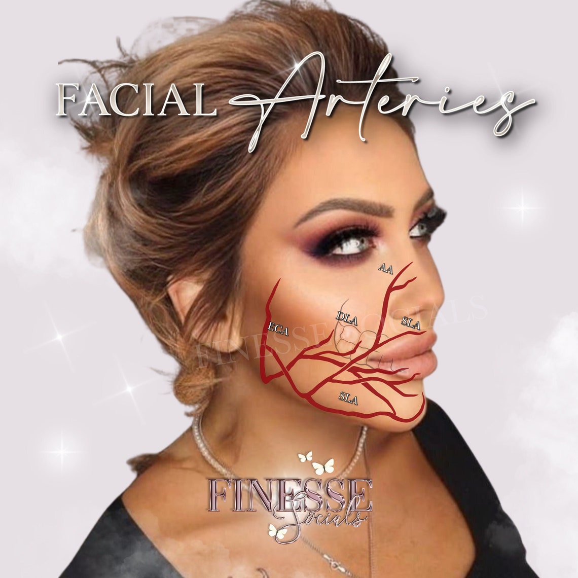 Facial Arteries Overlay side Profile for Aesthetics Practitioners 1 ...