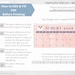 Editable Meeting Notes, Meeting Notes Printable, Digital Download ...